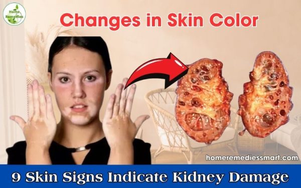 9 Skin Signs That May Indicate Kidney Damage